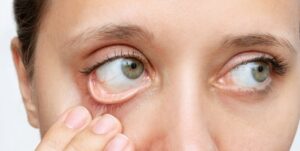 5 Reasons for Low Iron and How It Relates to Thyroid Disease - Suzy ...