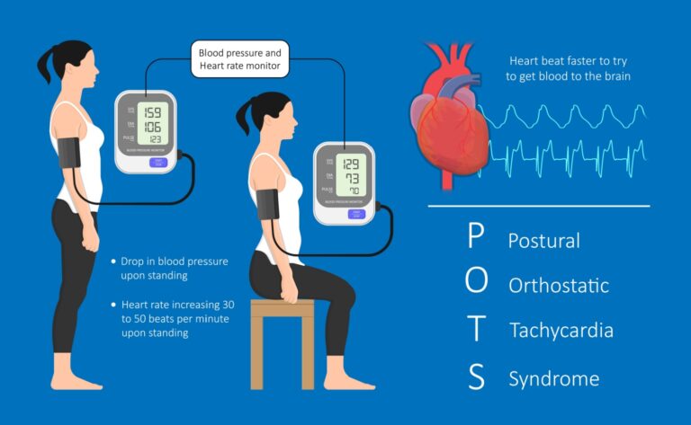 POTS: 4 Ways That Salt Affects Your Blood Pressure - Suzy Cohen, RPh ...