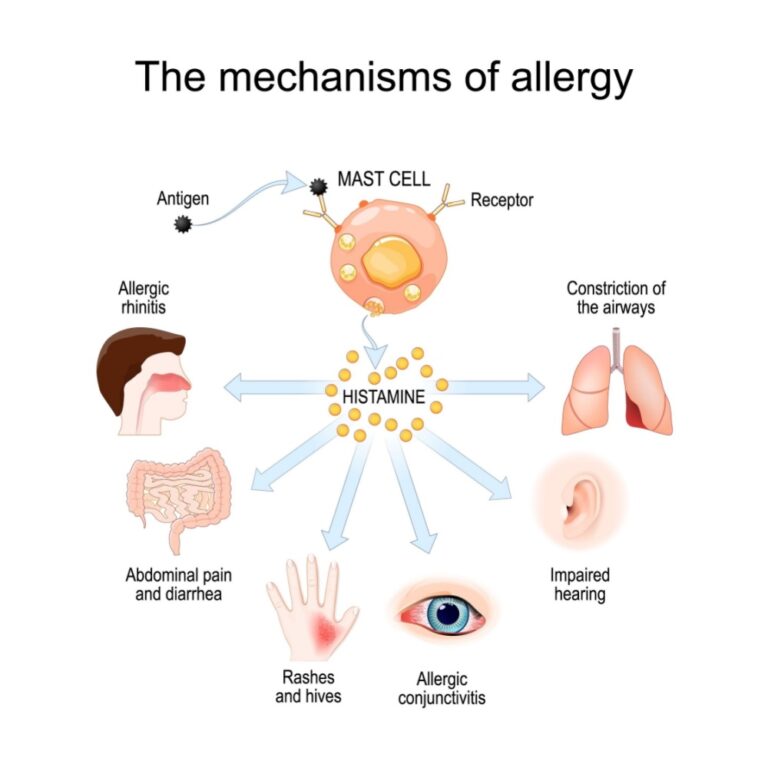 Allergies and Your Genes - Histamine Intolerance and DAO Enzyme - Suzy ...