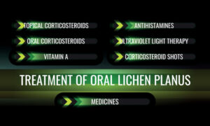 Oral Lichen Planus vs. Oral Cancer: 5 Visual Differences You Need to Know - Suzy Cohen, RPh ...